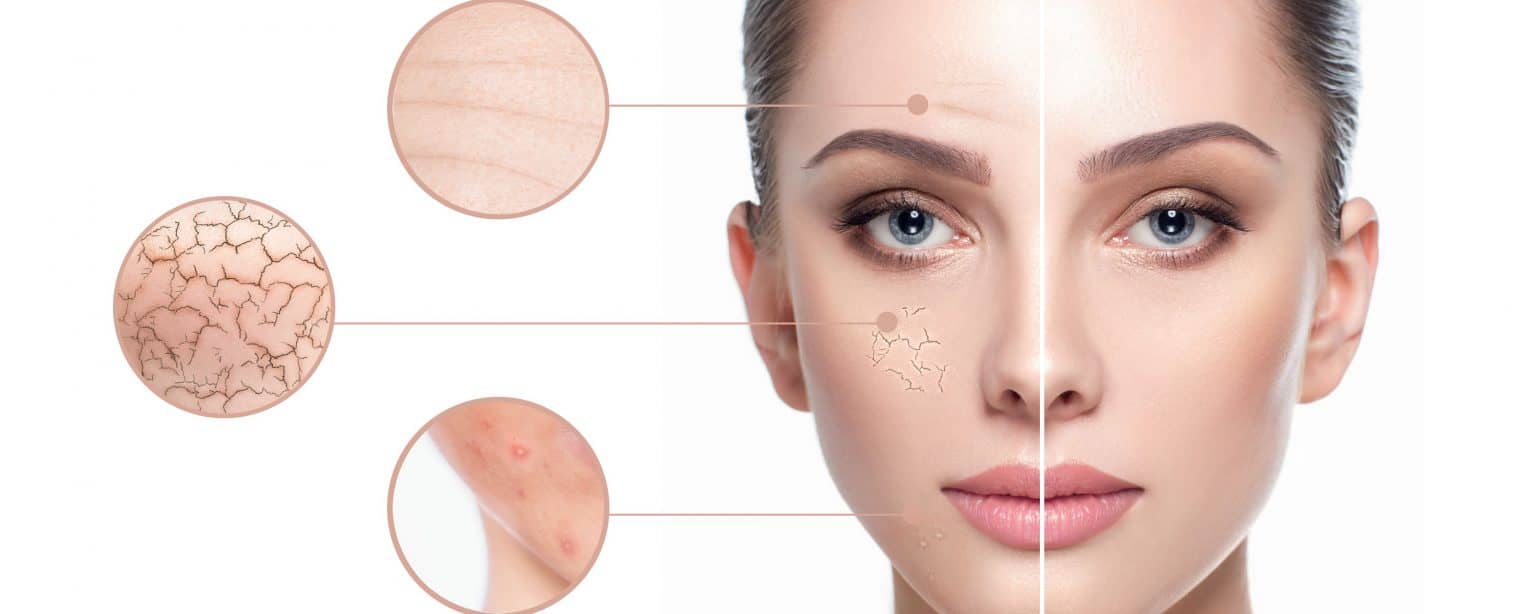 Unlock Your Best Skin: The Power of a Professional Skin Analysis - Vie ...