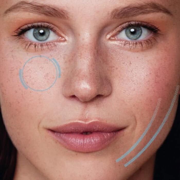 What Is The Best Non-Surgical Jowls Lift in 2024? - Vie Aesthetics